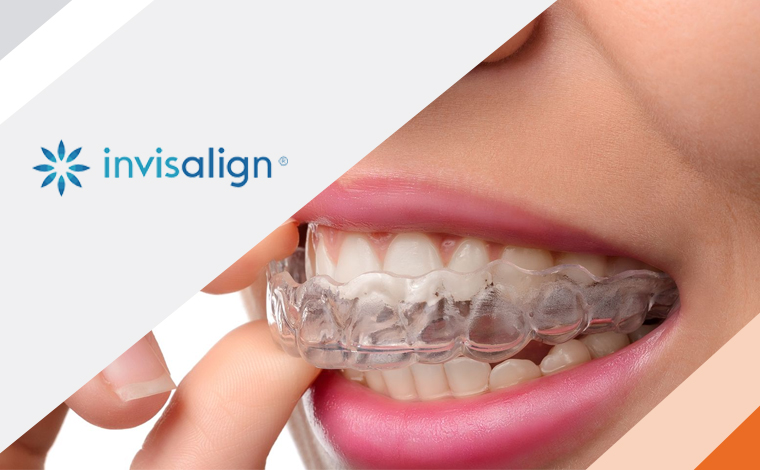 Invisalign in Irvine, CA | Invisalign Near You